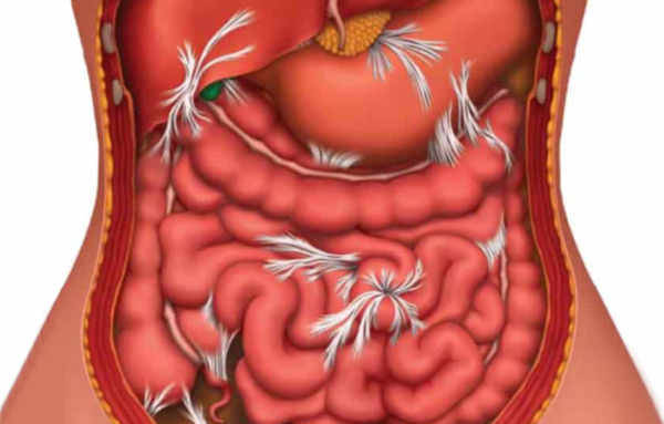 Visceral Manipulation – DrInaKuhar